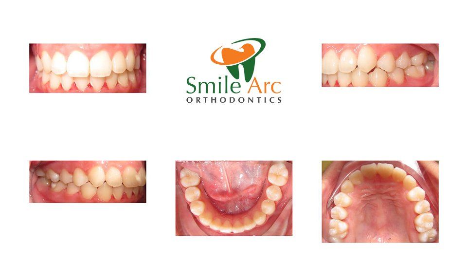 Smile Arc Orthodontics Photo Gallery | Lancaster, PA